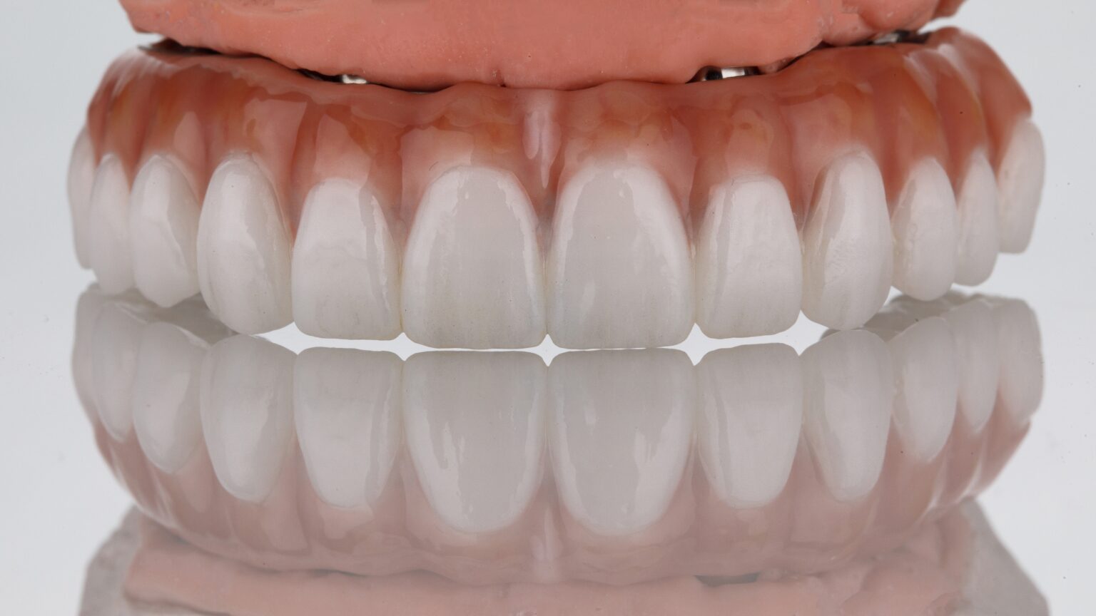 Are Dentures My Best Option for Replacing Many Teeth in Golden, CO?